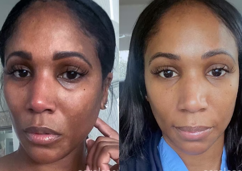 Laser Skin Therapy – Seraphim Beauty